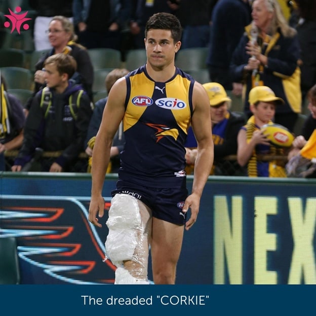 How Long Does It Take for a Corked Thigh to Heal?